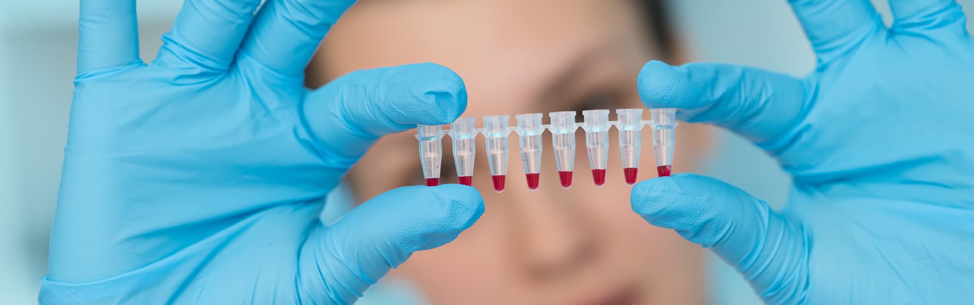 ECU | World Class Haemochromatosis Research